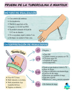 ¿Qué es la prueba de Mantoux? - On-enfermería