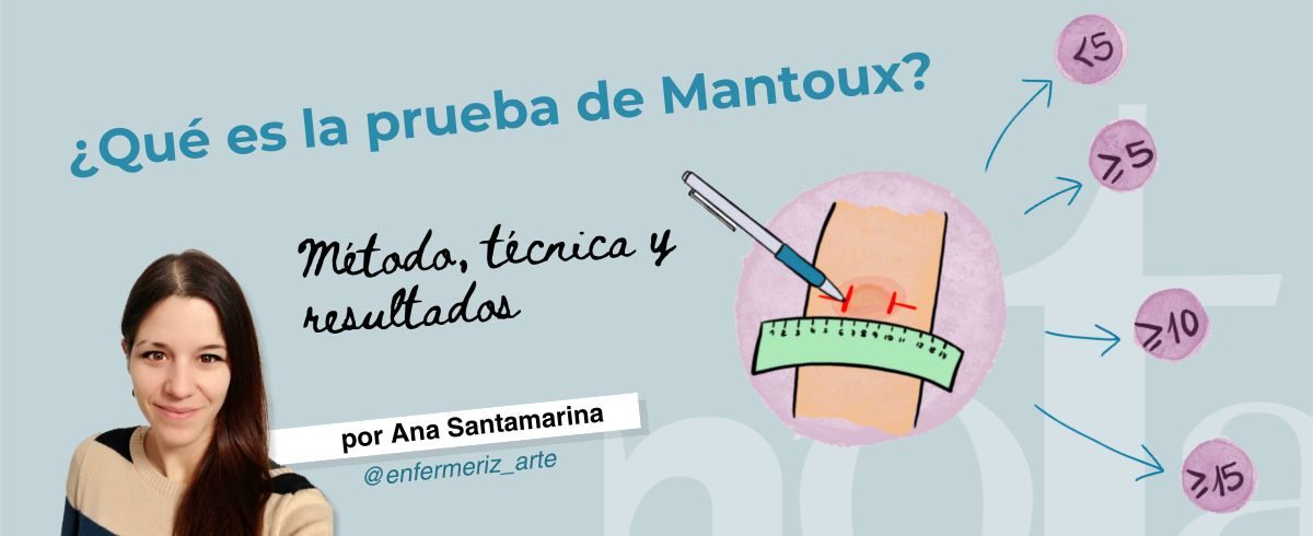  Qu Es La Prueba De Mantoux On enfermer a